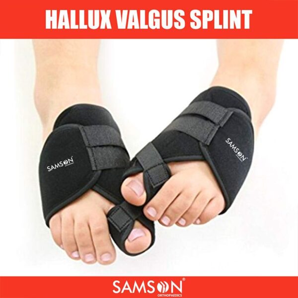 HALLUX VALGUS SPLINT ( SAMSON ) - Qasr Elteb